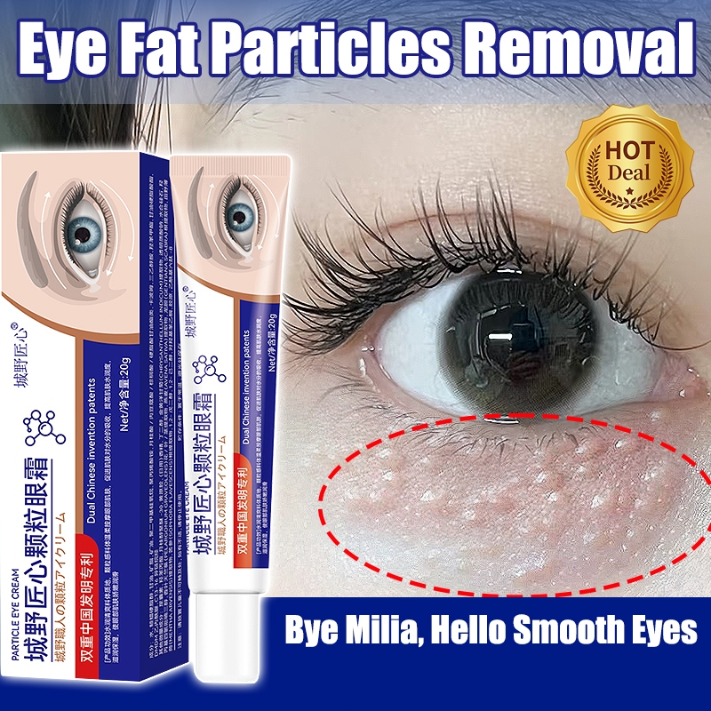 Japan Eye Cream Milia Seed Removal 20g Efficient Remove Fat Particle ...