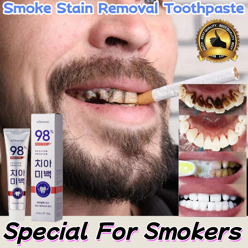 KORMESIC Tobacco Stain Removal Toothpaste 100g Tobacco Stain Removal ...