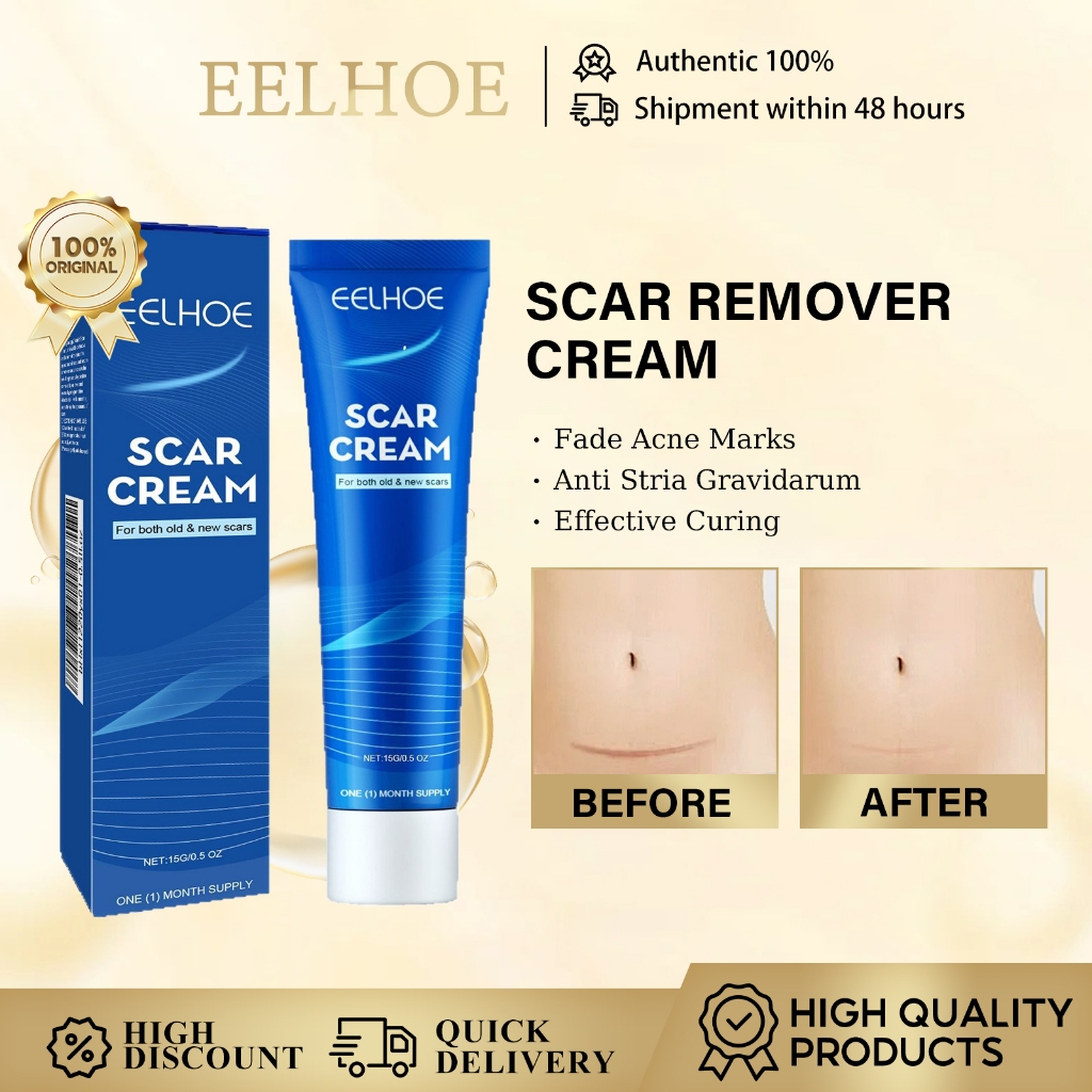 EELHOE Scar Cream 15g - Helps lighten Old & New Peklat, Pimple Marks ...