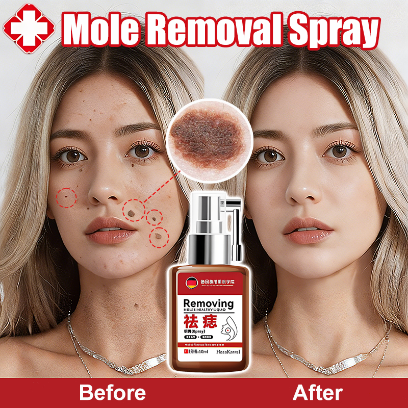 Mole Removal Spray 60ml Skin Tag Remover No Trace Mole Remover Rapidly ...