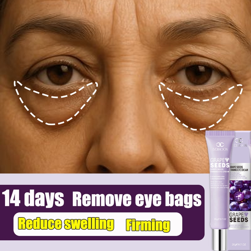 LYDIMOON eye bag removal cream 20g remove eye bags dark circles fine ...