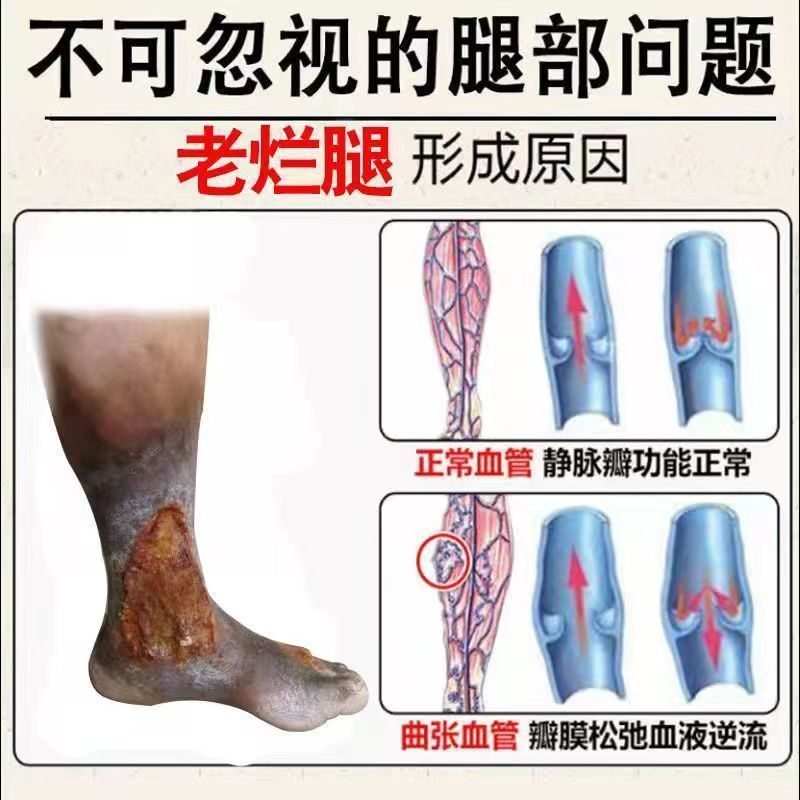 Trauma antibacterial solution 100ml Rapid wound healing scabbing rotten ...
