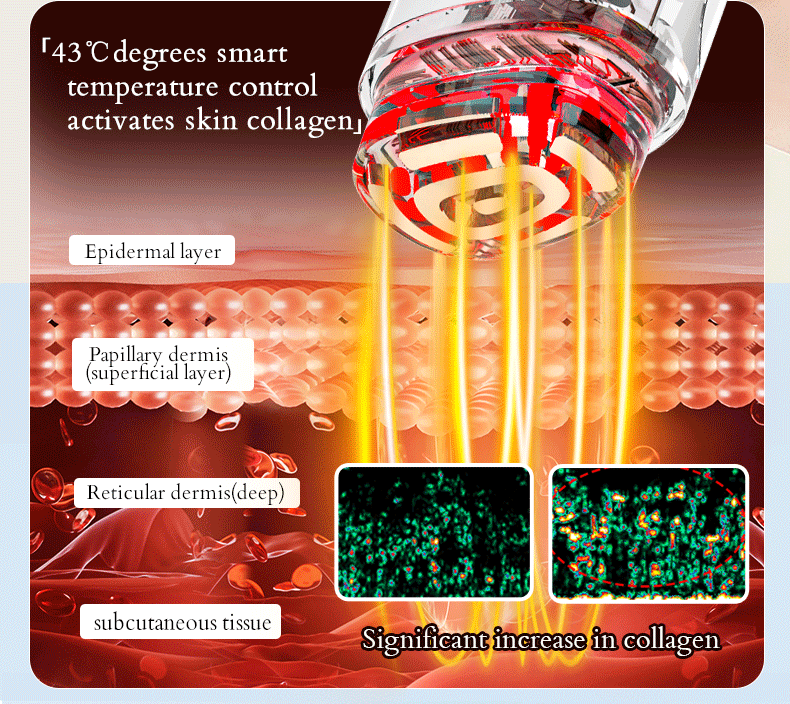 BIOSKIN Smart RF Beauty Device Light-seeking Beauty Instrument Eye ...