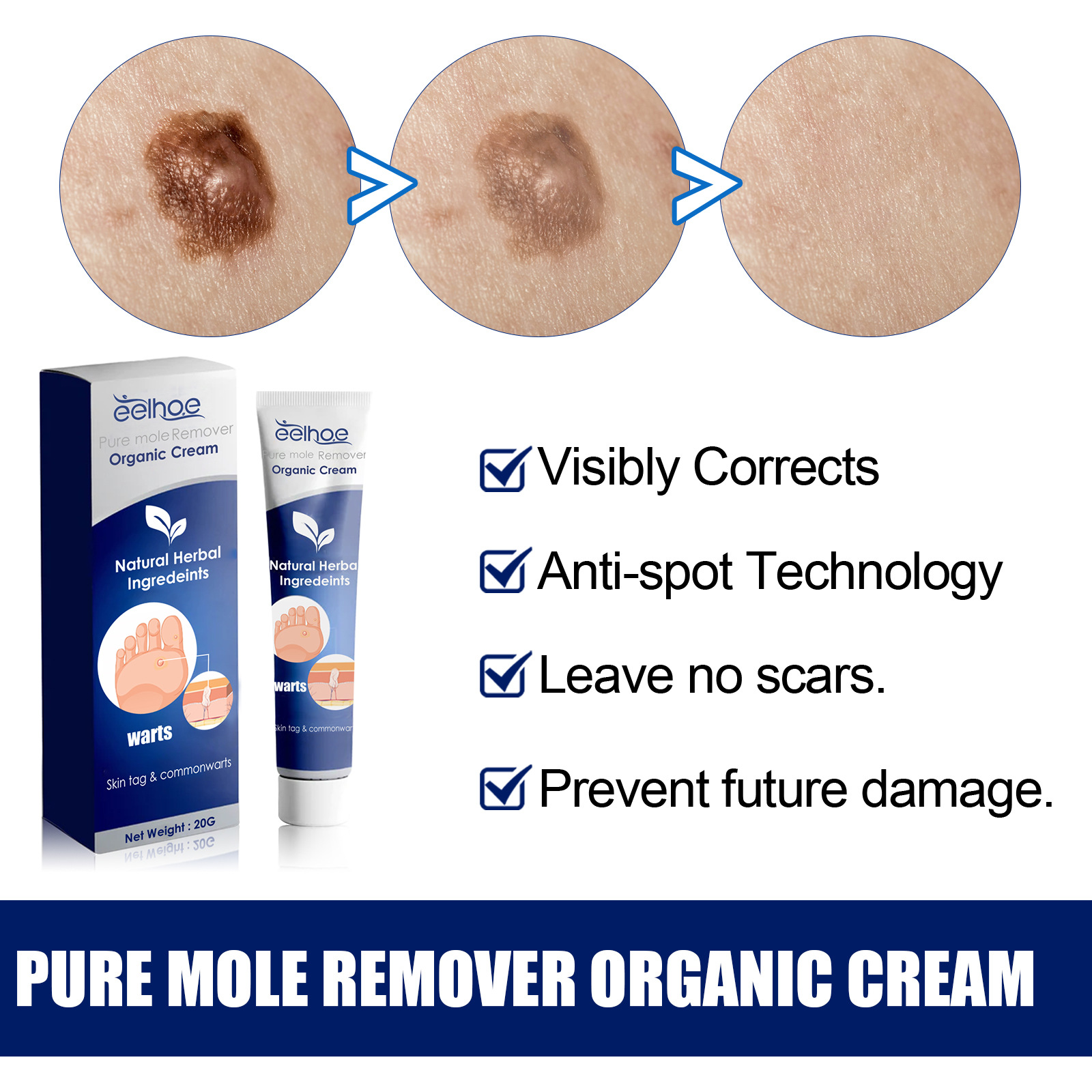 Eelhoe Pure Mole Remover Organic Cream Skin Tags Remover Warts Remover ...