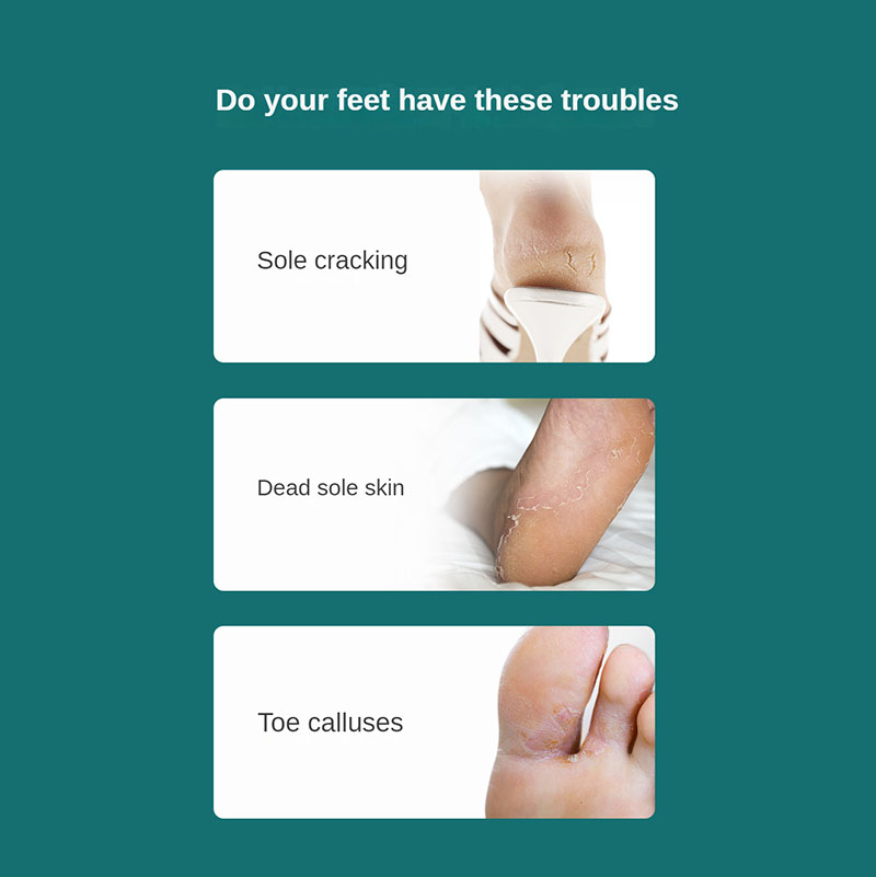 Manicure Pedicure Tools Toe Nail Shaver Feet Pedicure Knife Kit Foot ...