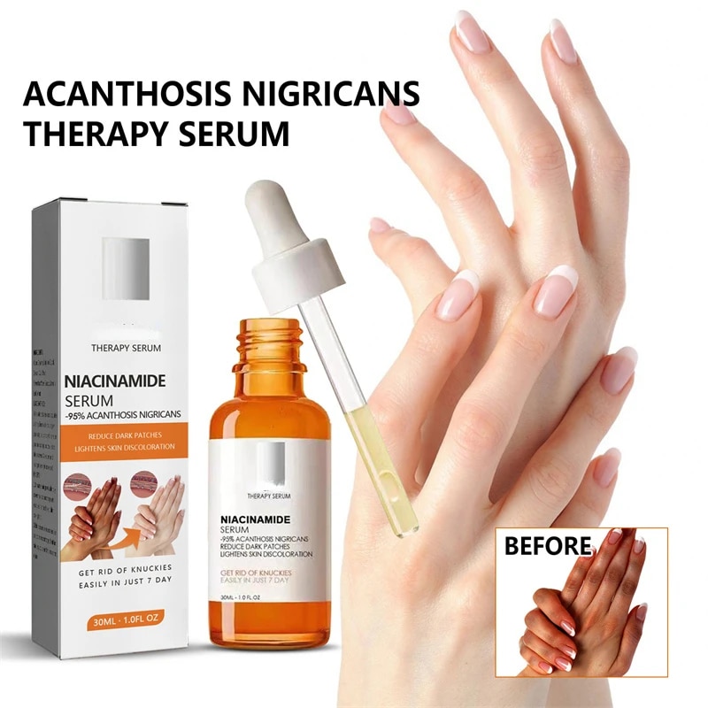 Dark Knuckles Fast Whitening Serum Pigmentation Correctors for Black ...