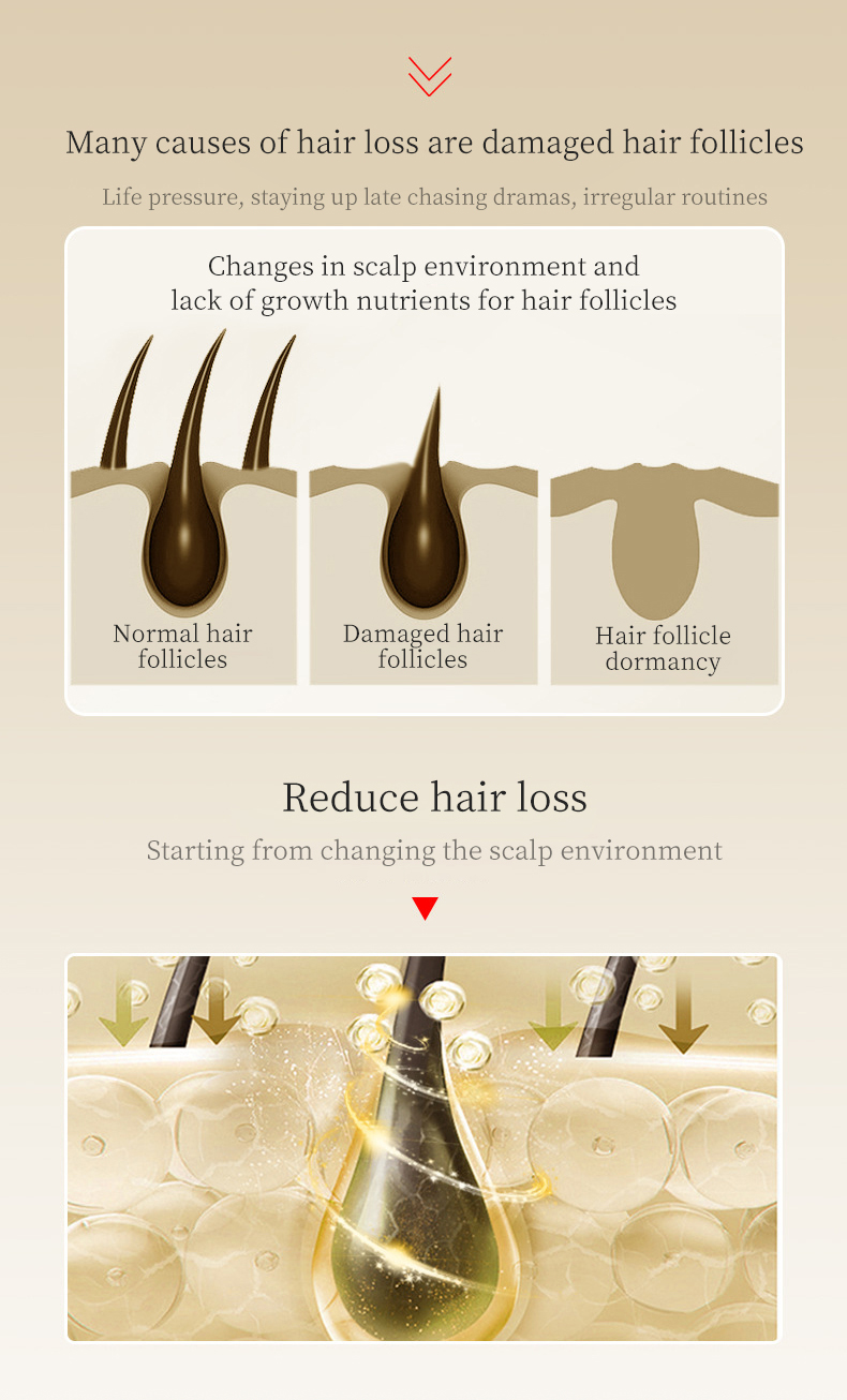 【SG Stock】Ginger Hair Shampoo 500ml Anti-Hair Loss Hair Growth Original ...