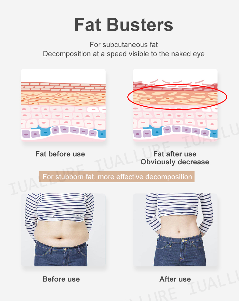 Slimming Cream Professional Losing Weight Cream Firming and Burning Fat ...