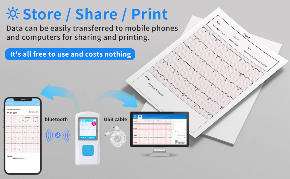 EKG Monitor Device Personal Heart Rate Monitor with LCD Screen and ...