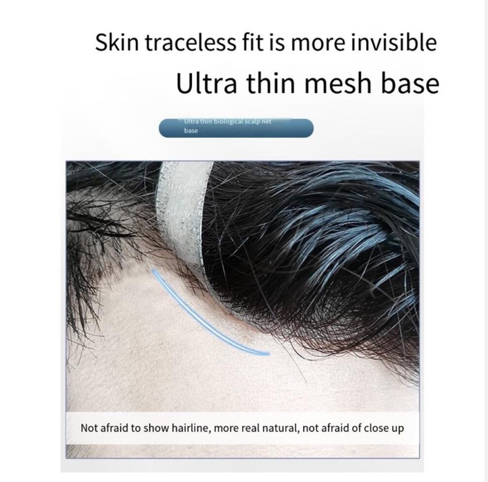 Wig Men's and women's hairline fake hair patch forehead Men's and women ...