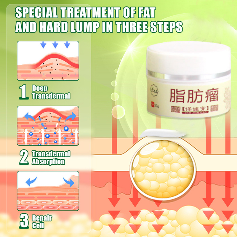 Lipoma Removal Cream 30g Removing Lumps in the Body Lymph Nodes ...