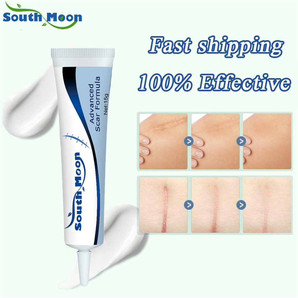[South Moon] Scar Removal Cream and Scar Removal Gel Perfect removal of ...