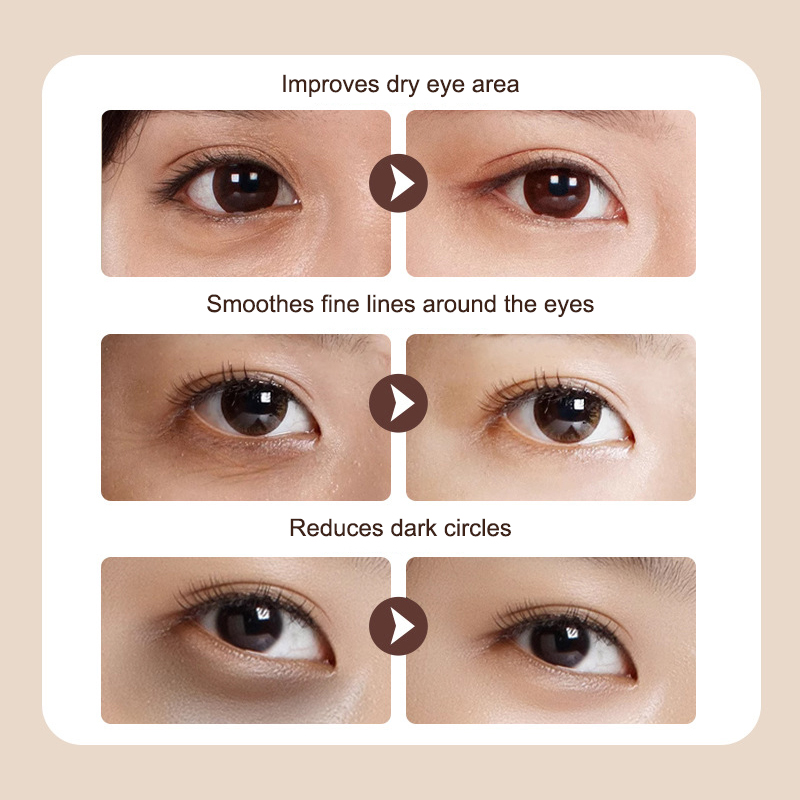 Instant eye bag removal cream Eye massage firming essence Dark circles ...