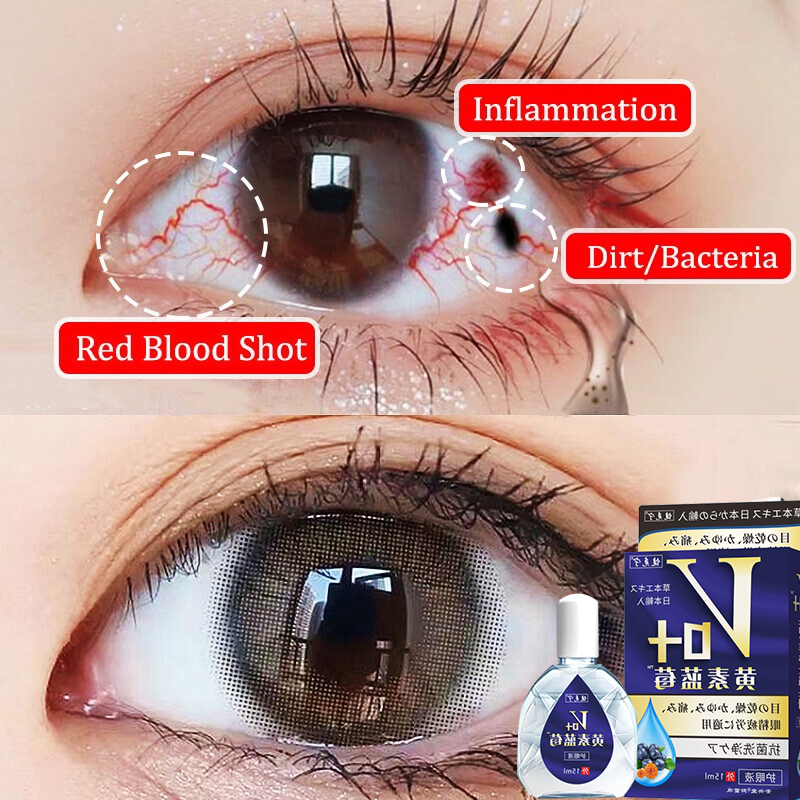 lutein eye supplement eye drops for dry eyes 15ml lutein Effectively ...