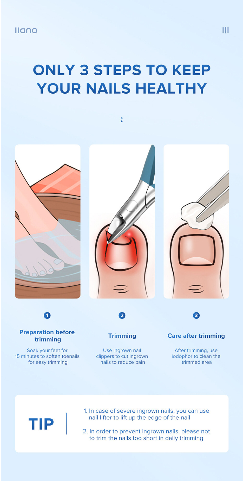 Llano Ingrown Nail Clipper Toenail Cutter Stainless Steel Pedicure ...