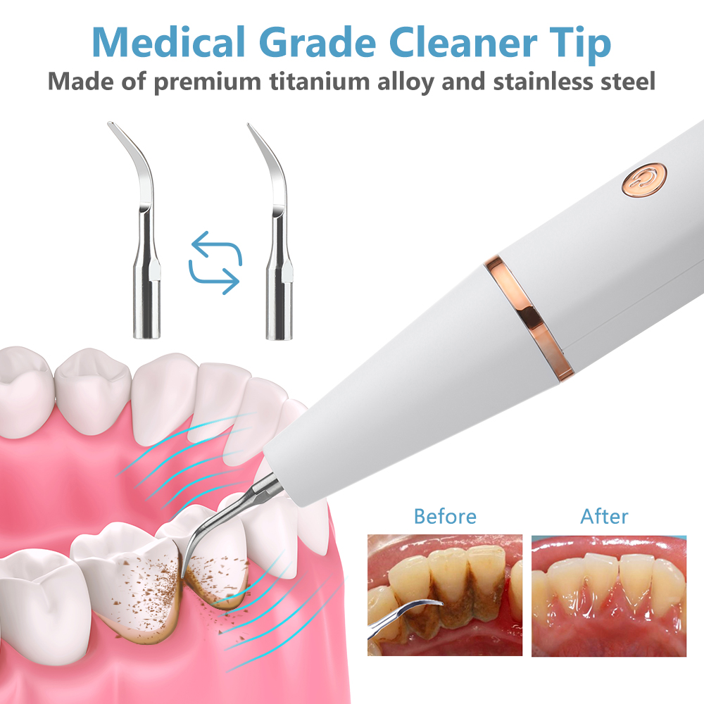 Ultrasonic Dental Scaler For Teeth Tartar Stain Tooth Calculus Remover ...