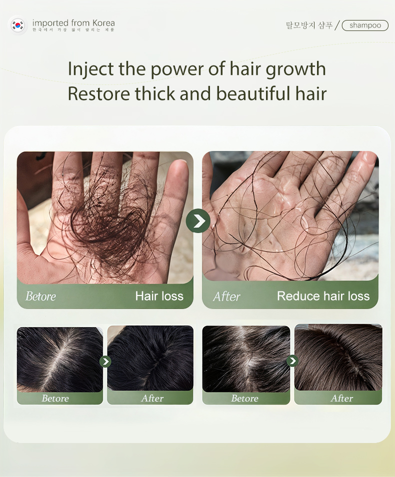 Dr.Ville Hair Growth Shampoo Hair Tonic For Hair Growth Powerful ...
