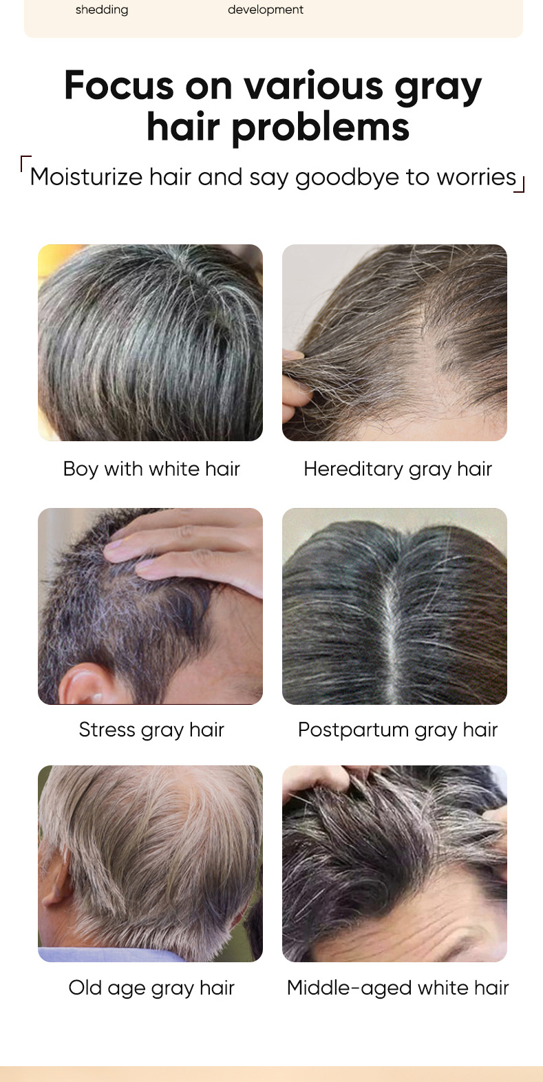 Eliminate gray hair Permanent black hair White hair to black hair serum ...