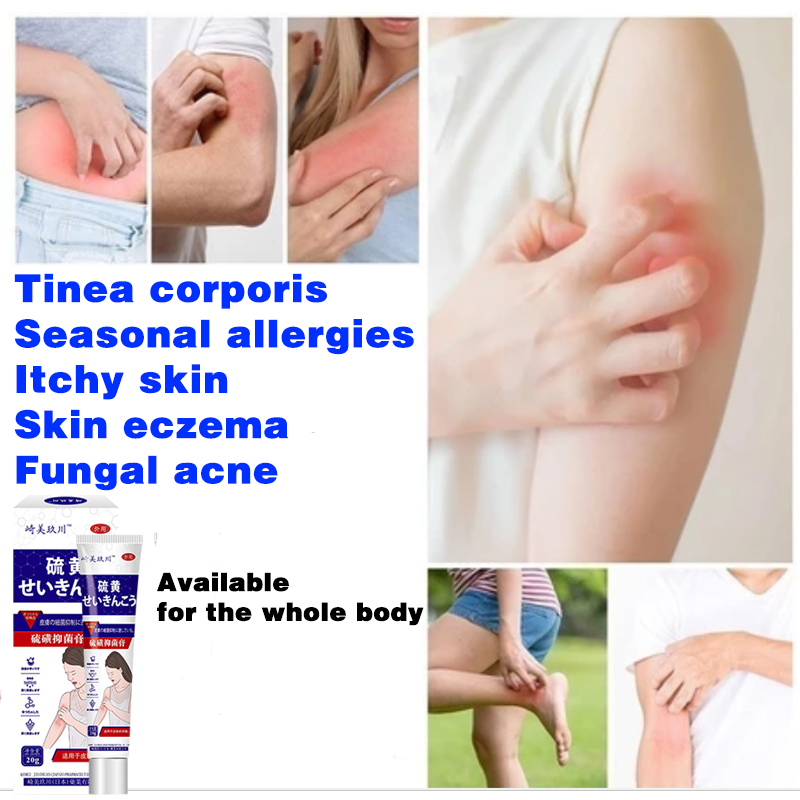 Japan itching cream eczema cream 20g antifungal for redness allergy Itchy skin sulfur private ...