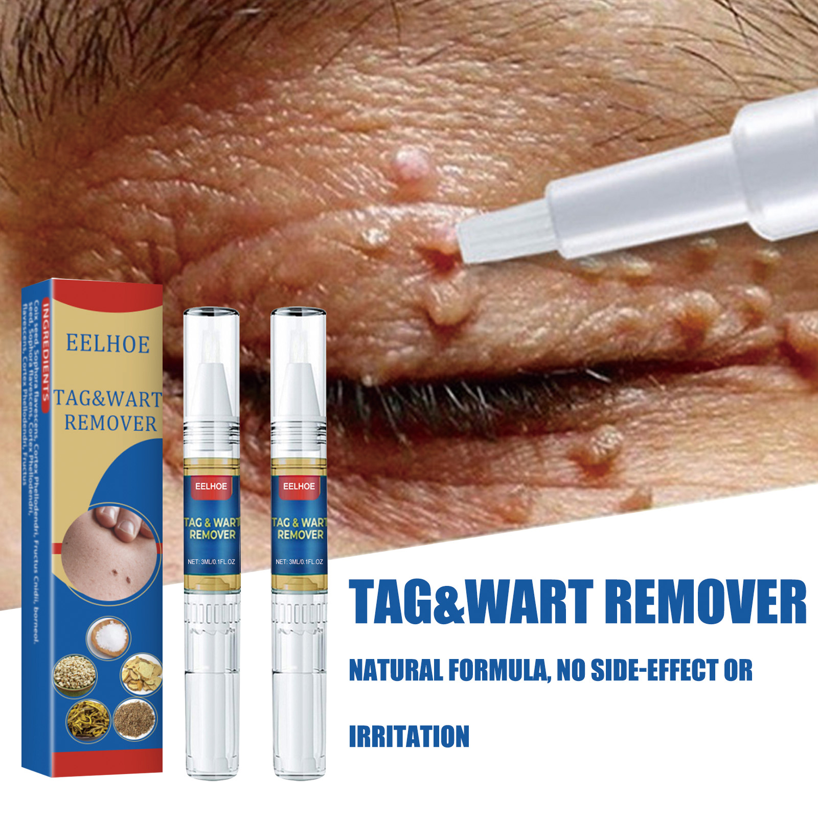 Warts Removers Warts And Skin Tag Removers Warts Ointment Warts Magic ...