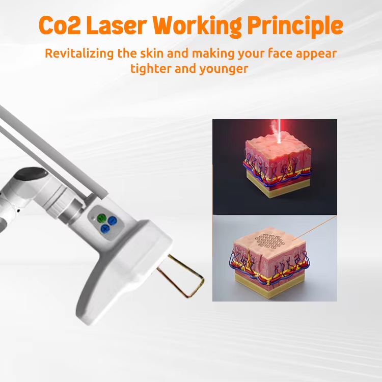 【Physical Store Experience】Newest Products Laser Beauty Equipment Scars ...
