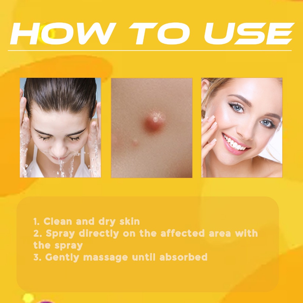 20ml Tag Recede Bee Venom Repair Spray Advance Wart RepairSpray for All ...