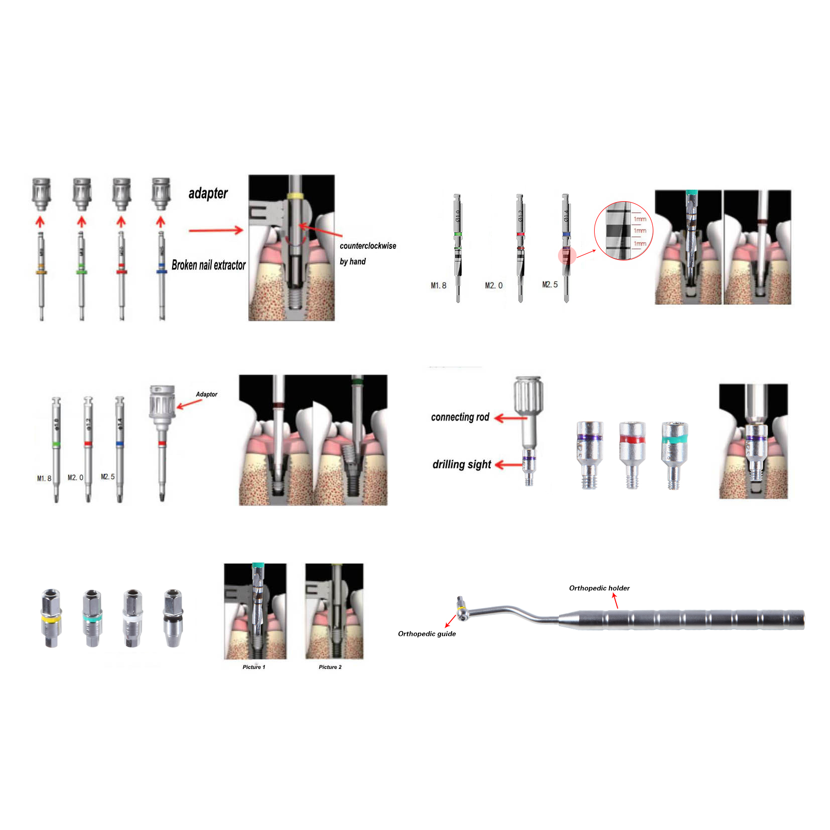 Dental Implant Broken Screw Remover Kit Reverse Drill Guide Driver SR ...