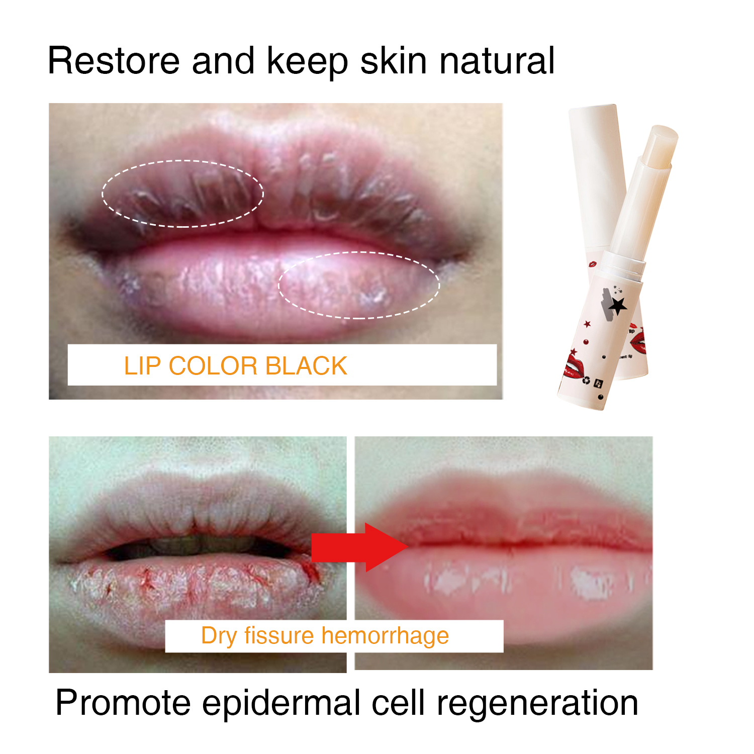 Lipstick lip balm for remove dark lip 5g Remove Dark Lip LinesDry ...