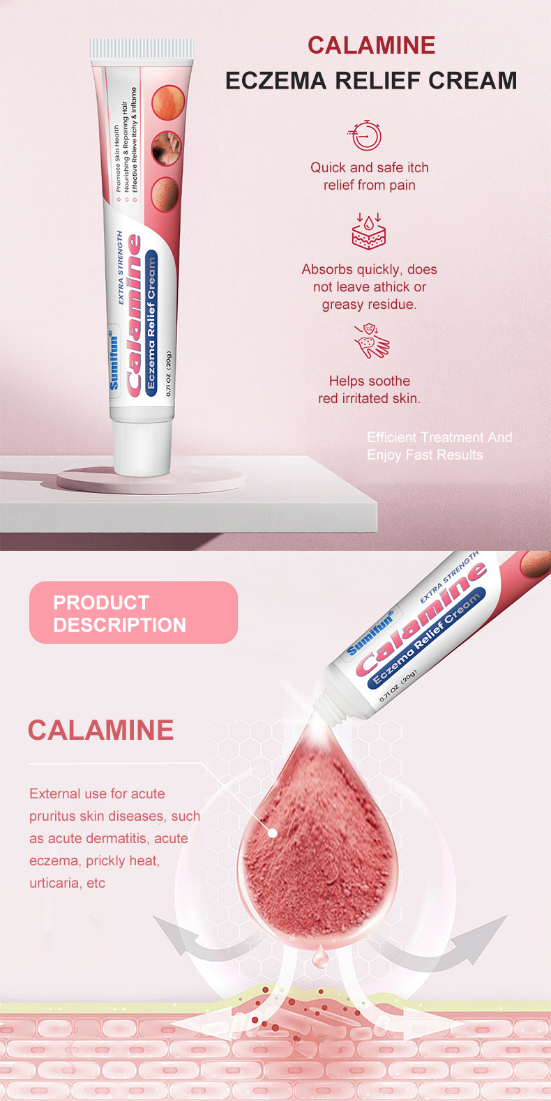 Psoriasis cream Antifungal cream 20g Inhibit fungi/relieve rash ...