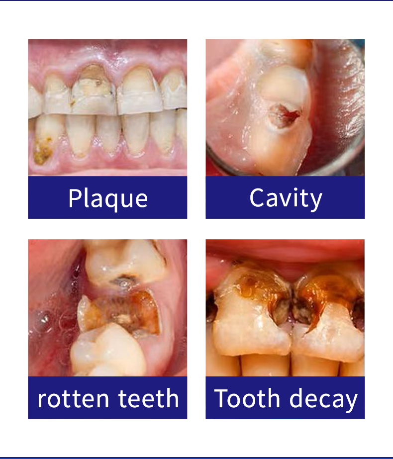 Tooth Whitening Toothpaste Tooth Decay Repair Remove Stains Yellow ...