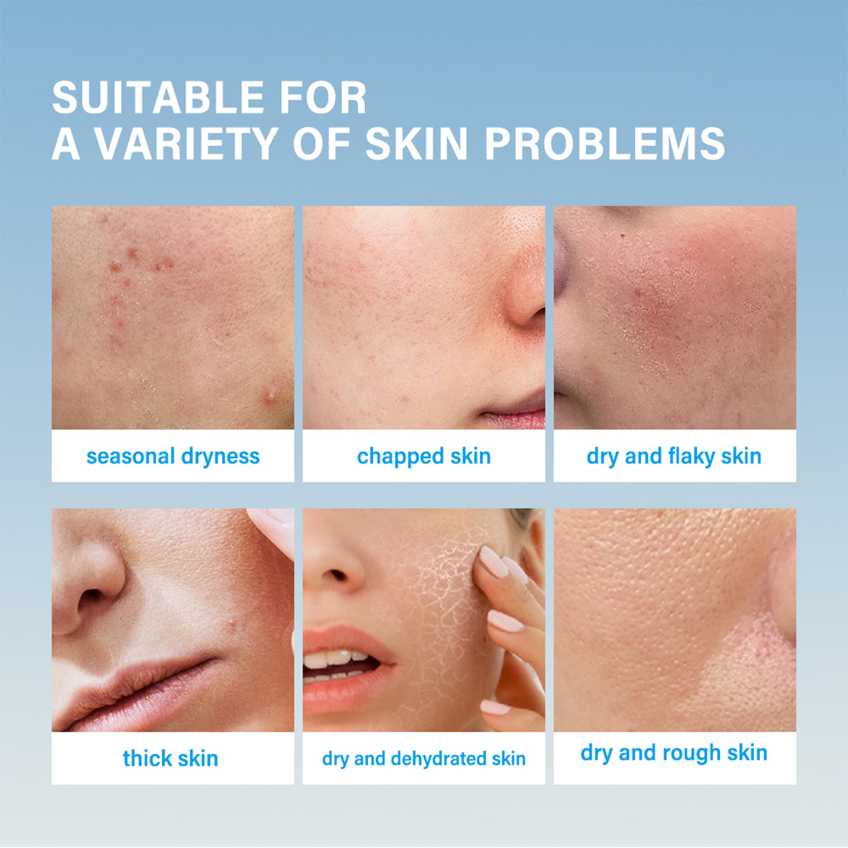 Lakerain Ceramide & Squalane Face Cream, Lightweight Hydrating ...