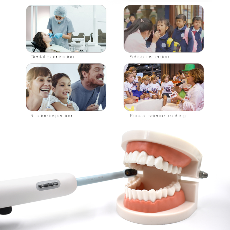 Wireless Dental Endoscope Camera 2 Million Pixel HD Tooth Digital ...