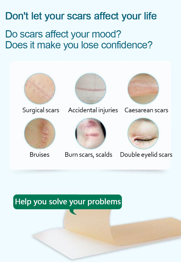 Local seller⚡Silicone Scar Removal Patch - Effective for Acne Scars ...