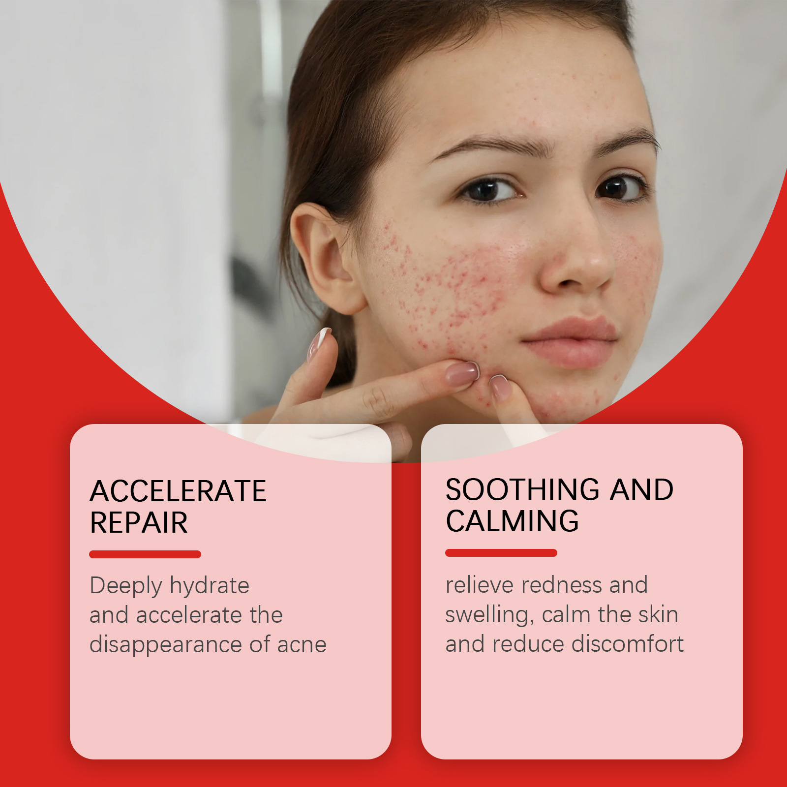 Pimple Patches For Face, Hydrocolloid Acne Pimple Patch For Covering ...