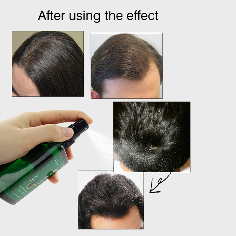 Hair growth spray hair growth serum120ml Anti Hair Loss Spray hair loss ...