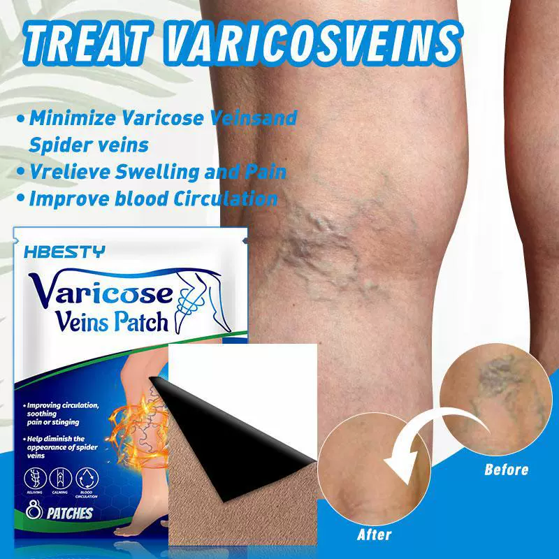 Varicose Vein Patch 8 patches/box Varicose Vein Effective Removal Patch ...