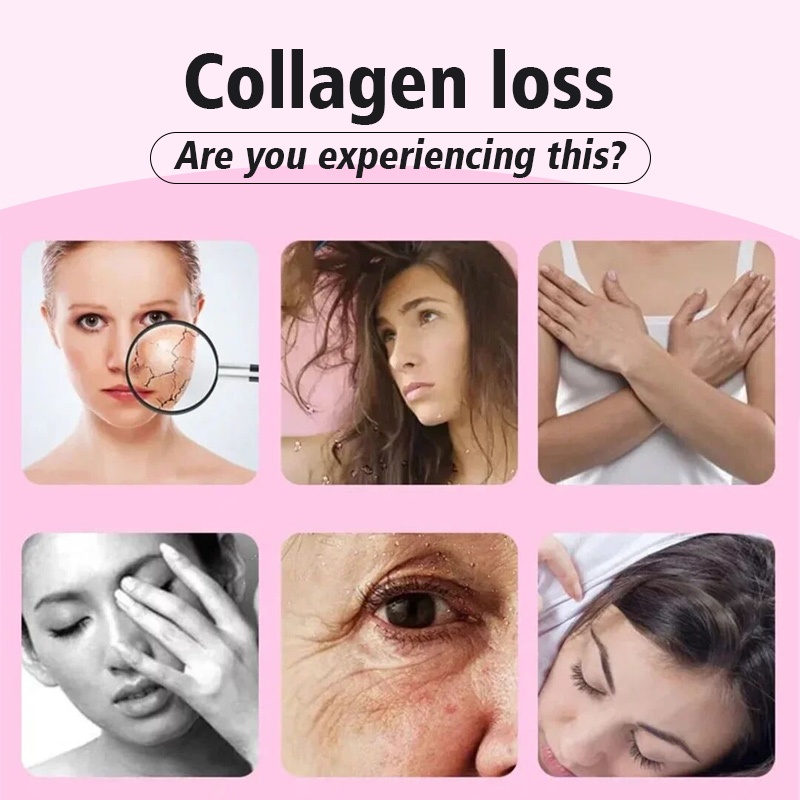 Trorexl Collagen Glutathione Supplement Skin Elasticity Brightness Anti ...