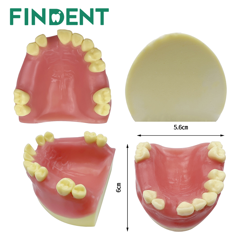 1Pcs Dental Implant Practice Model Maxillary Mandibular Basic Implant ...