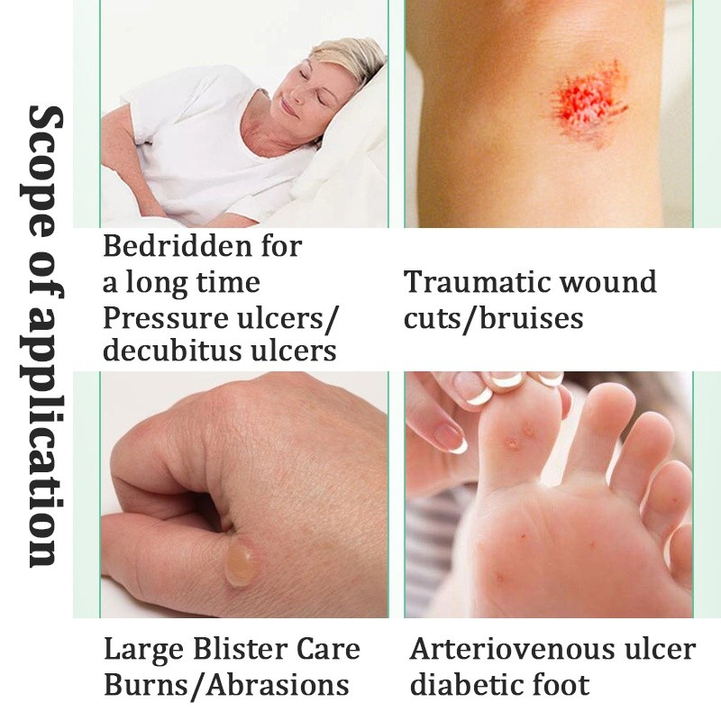 1PC Medical Hydrocolloid Adhesive Dressing Wound Dressing Sterile ...