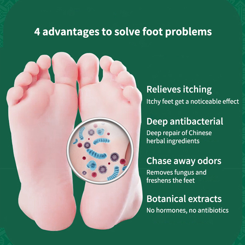 Foot fungus treatment Anti fungal spray 30ml Athlete foot Deodorant and ...