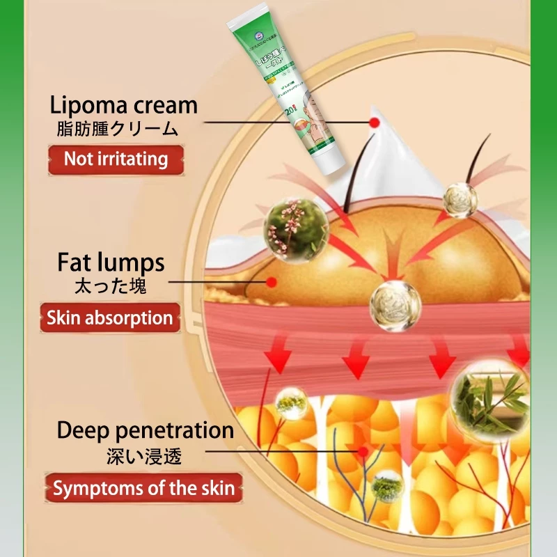 Japan 100% original lipoma removal cream Fatty Cellulite Cream 20g ...