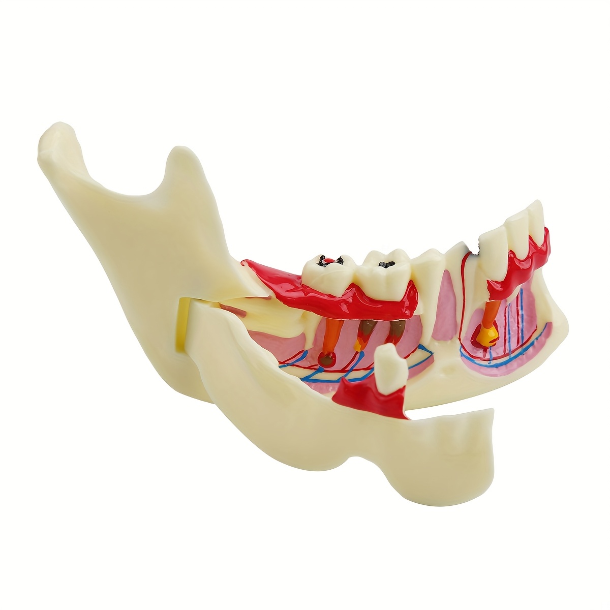 Dental Endodontic Treatment Model Anatomy of Gums Mandible Tissue ...