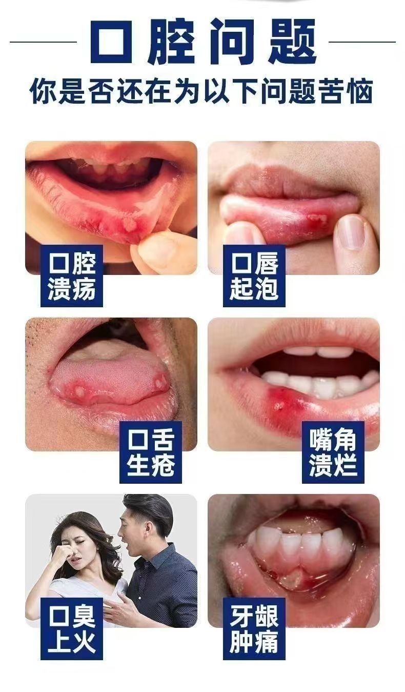 【ready stock】Watermelon Cream Old Brand Oral Ulcer Spray Tongue Foaming ...