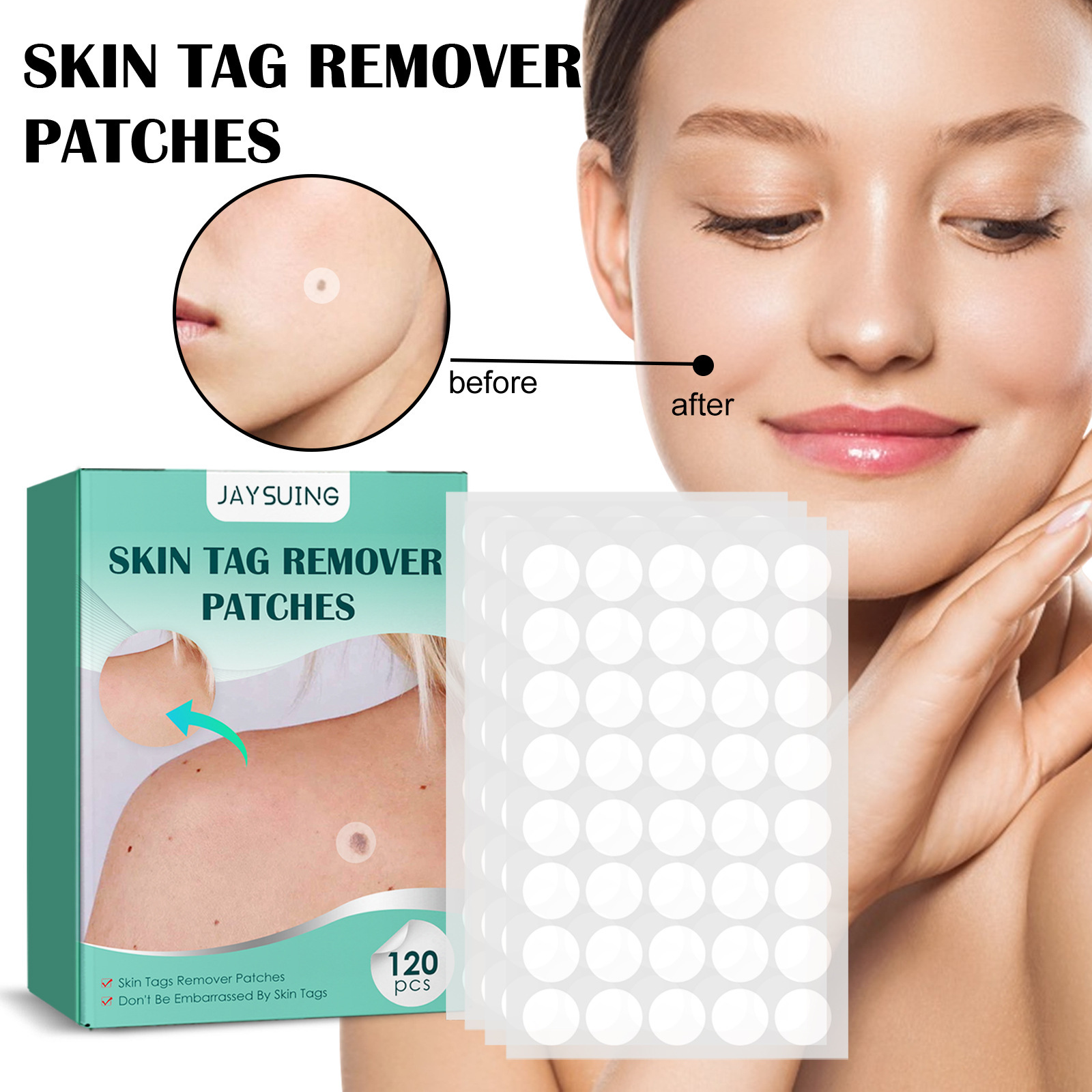 120 Pieces/Box Wart Removal Patch, Safe and Painless, Skin Tag Patch ...