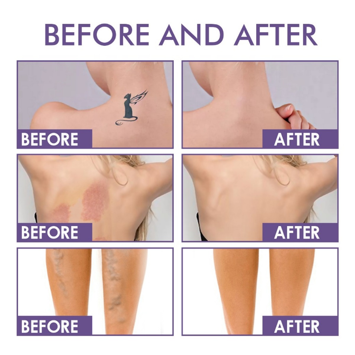 Waterproof Tattoo Concealer Body Concealer For Dark Spots Scars ...