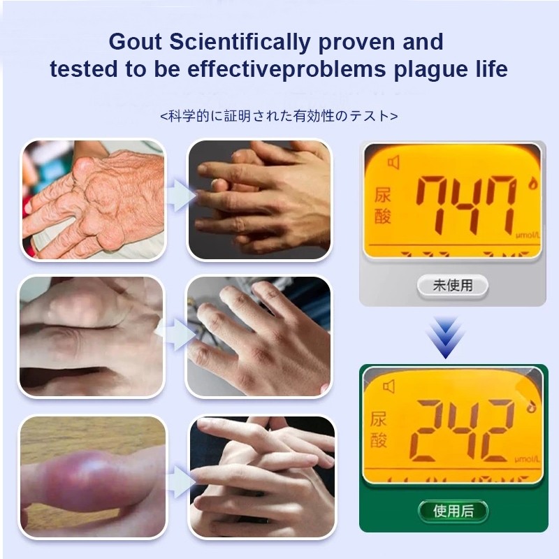 Japan Gout Patch Gout Medicine Joint Pain Relief Patch Gout medicated ...