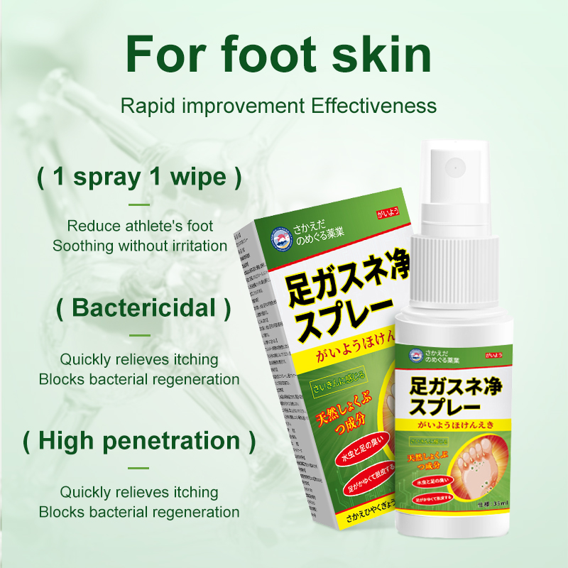 【SG Stock】Anti fungal Foot Spray Athlete's Foot Treatment Spray 35ml ...