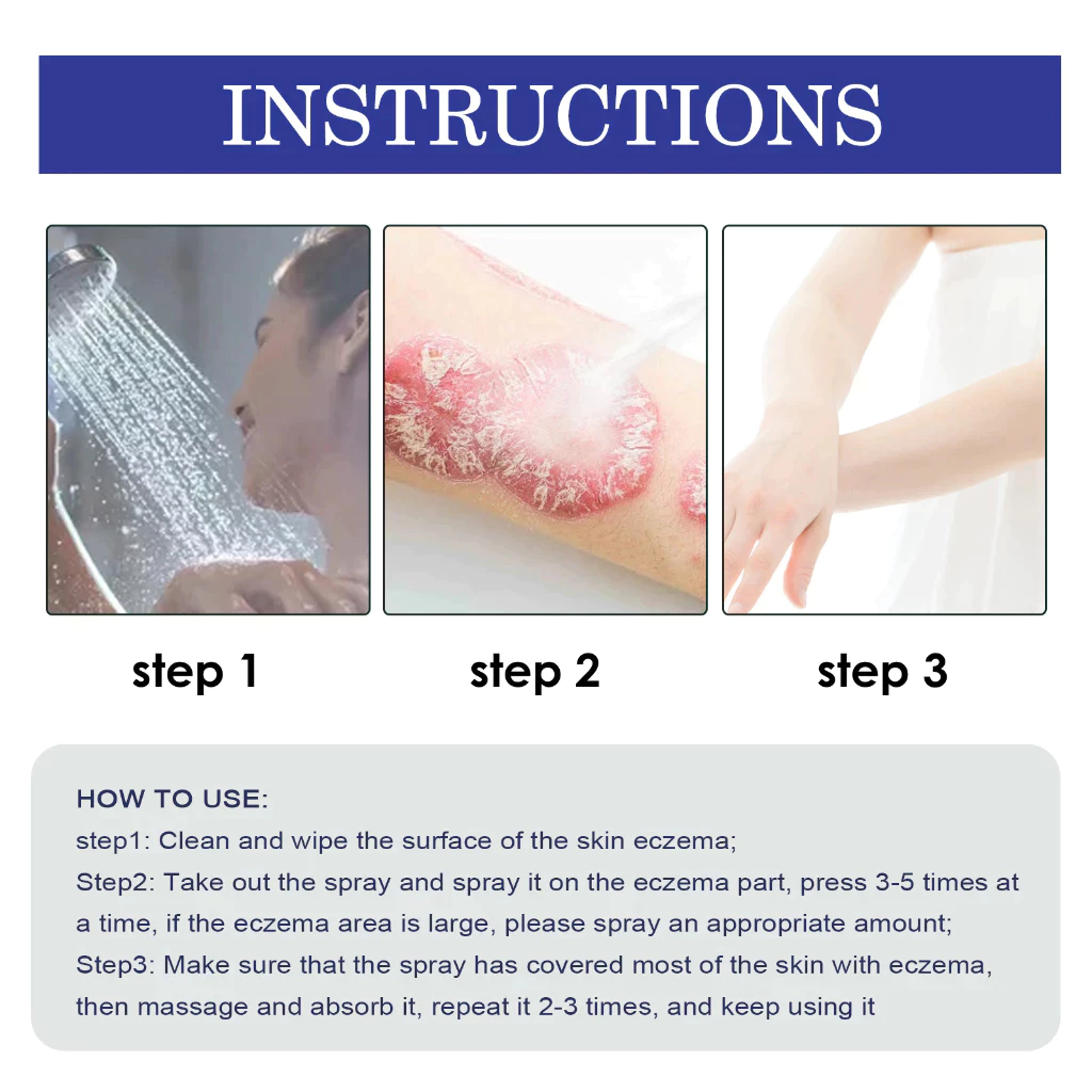 Psoriasis Spray Eczema anti itch Spray psoriasis remission dermatitis ...