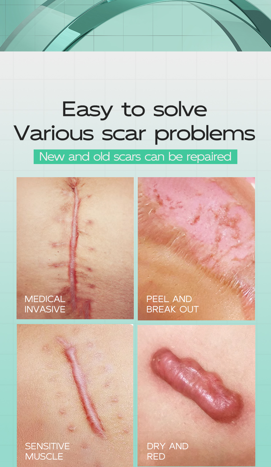 New Maycheer Scar Cream Deep Repair Fade Scar Moisturizing and Reducing ...