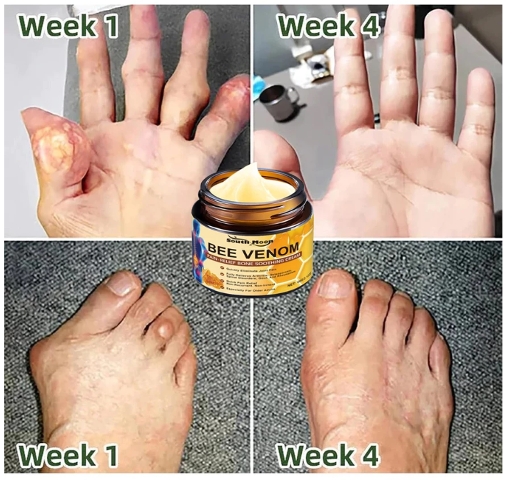 Bee Venom Joint Relief Cream 60g Knee Pain Relief Reduces Joint Pain ...